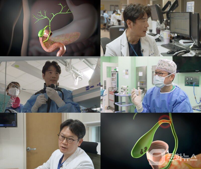 EBS 명의, '담도 담낭에 생긴 돌 암이 될까요?' 편 방송 : ZUM 뉴스