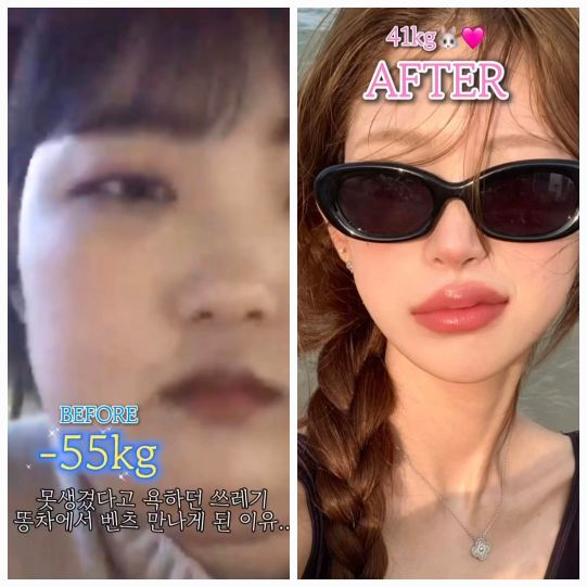 “못생겼다고 욕하던 그놈”… -55kg 감량 후 달라진 연애, 벤츠 탄 최준희 근황 : zum 뉴스