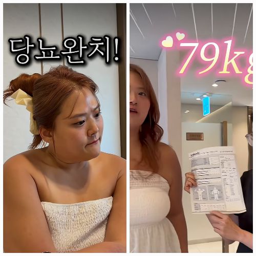 ‘72kg 감량’ 미나 시누이, 요요 없었다…“당뇨 완치” 진짜 복구는 몸이었다 : zum 뉴스