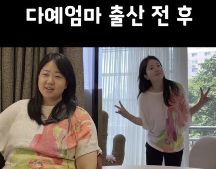 ‘박수홍 아내’ 김다예, -30kg 초스피드 감량 “50kg대” : zum 뉴스