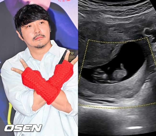 '13년만 두 딸 공개' KCM, 세 아이 아빠 된다…"진짜 깜짝이야" 초음파 사진 공개 [공식] : zum 뉴스