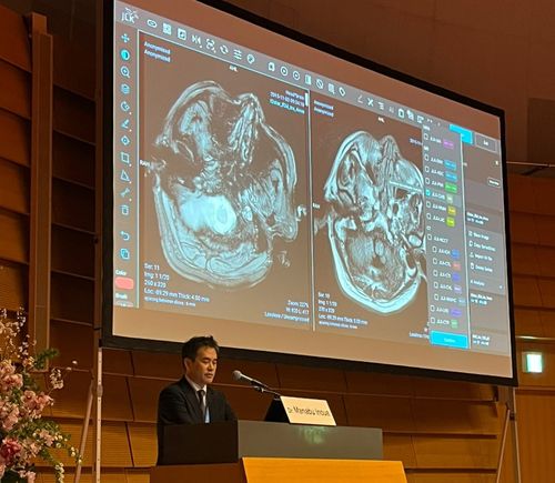 제이엘케이 "MRI 확산강조영상 AI 설루션, 日 인허가 획득" : ZUM 뉴스