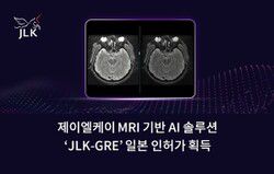 제이엘케이, 뇌 MRI AI 솔루션 'JLK-GRE' 일본 인허가 획득 : zum 뉴스