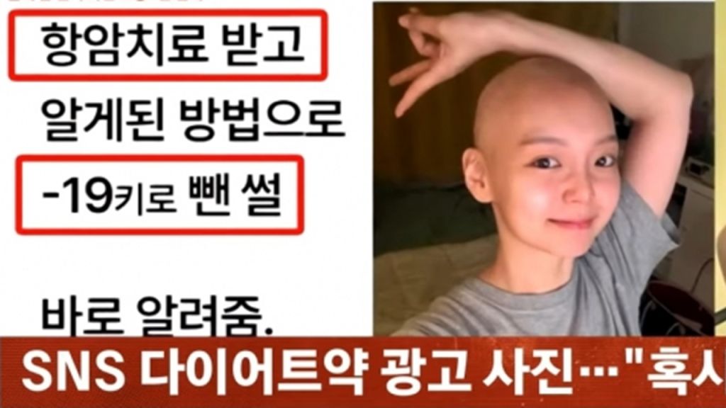 "항암제로 19kg 감량"…암 환자 사진 도용한 광고 논란 : zum 뉴스