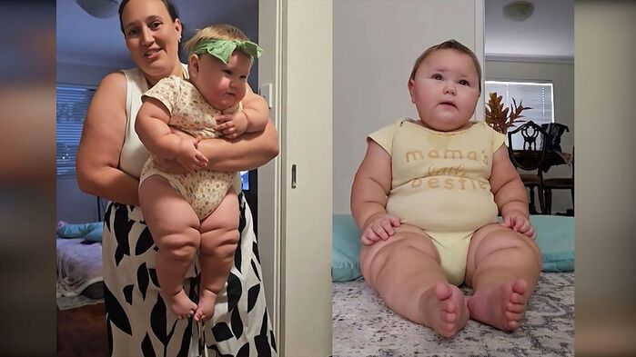 "패스트푸드 먹여서?"…16kg 생후 6개월 아기 '화제' : ZUM 뉴스