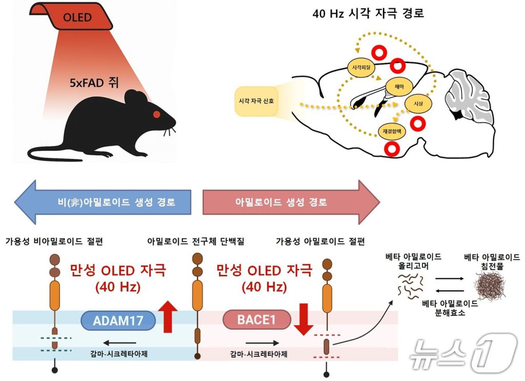 치매 '전자약' 나오나…광자극으로 알츠하이머 기억력 향상 확인 : zum 뉴스