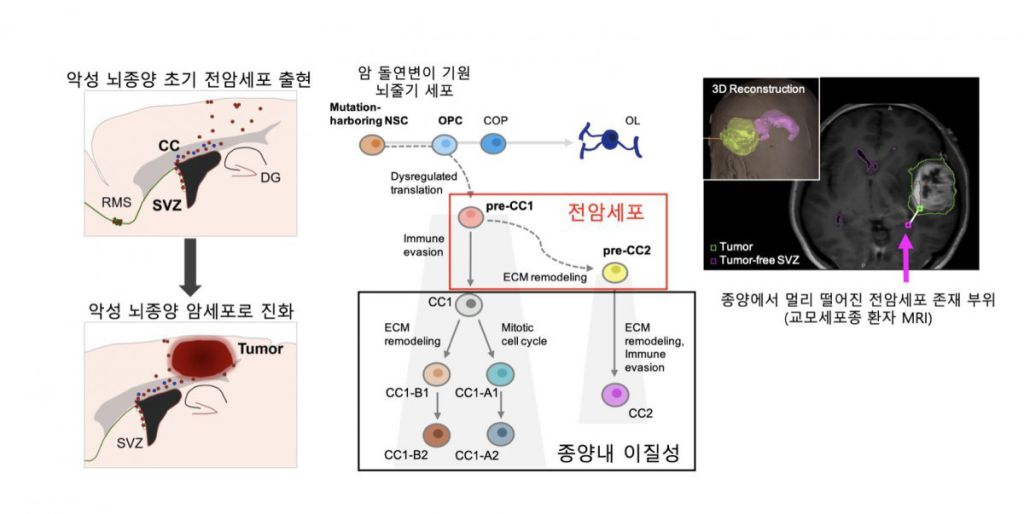 KAIST 연구진, 악성 뇌종양 키우는 ‘씨앗’ 찾아 : zum 뉴스