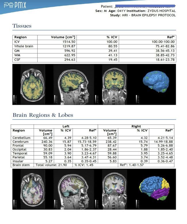"뇌 MRI 15분이면 끝"…해외서 먼저 알아본 한국 의료AI[빠정예진] : zum 뉴스