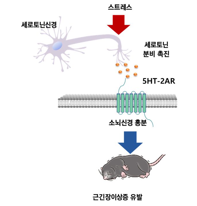 KAIST, 3대 운동질환 근긴장이상증 치료 약물 발견 : zum 뉴스