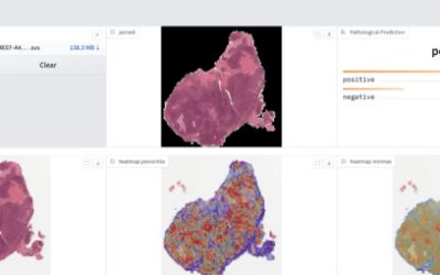 LG AI연구원, AWS 기술 활용 병리학 AI 모델 개발···데이터 준비 시간 60일→7일 : ZUM 뉴스