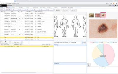 [WIS 2022]ETRI '노인 피부질환 진단 AI 기술' : ZUM 뉴스