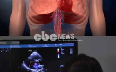 EBS '명의' 폐고혈압 원인과 치료법...장혁재 교수 : ZUM 뉴스