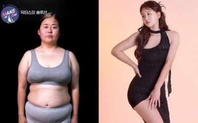 맥미걸, ‘위기의 아내’ 365mc 솔루션 받아…“지방흡입+30kg 감량” : ZUM 뉴스