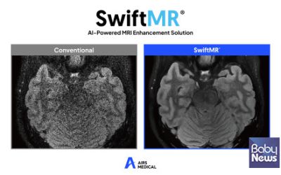 에어스메디컬, 서울대병원에 MRI AI솔루션 '스위프트엠알' 공급 : ZUM 뉴스