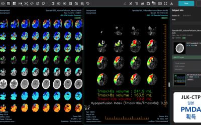 제이엘케이, 뇌졸중 솔루션 ‘JLK-CTP’ 美 이어 日 PMDA 인허가 획득 : ZUM 뉴스