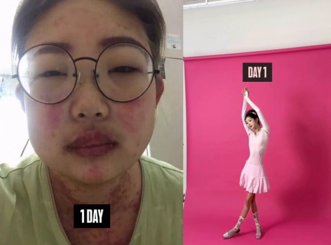 '55kg 감량' 최준희 "루프스 투병 중 하루 다섯끼+컵라면 6개 미친듯 먹어" : zum 뉴스